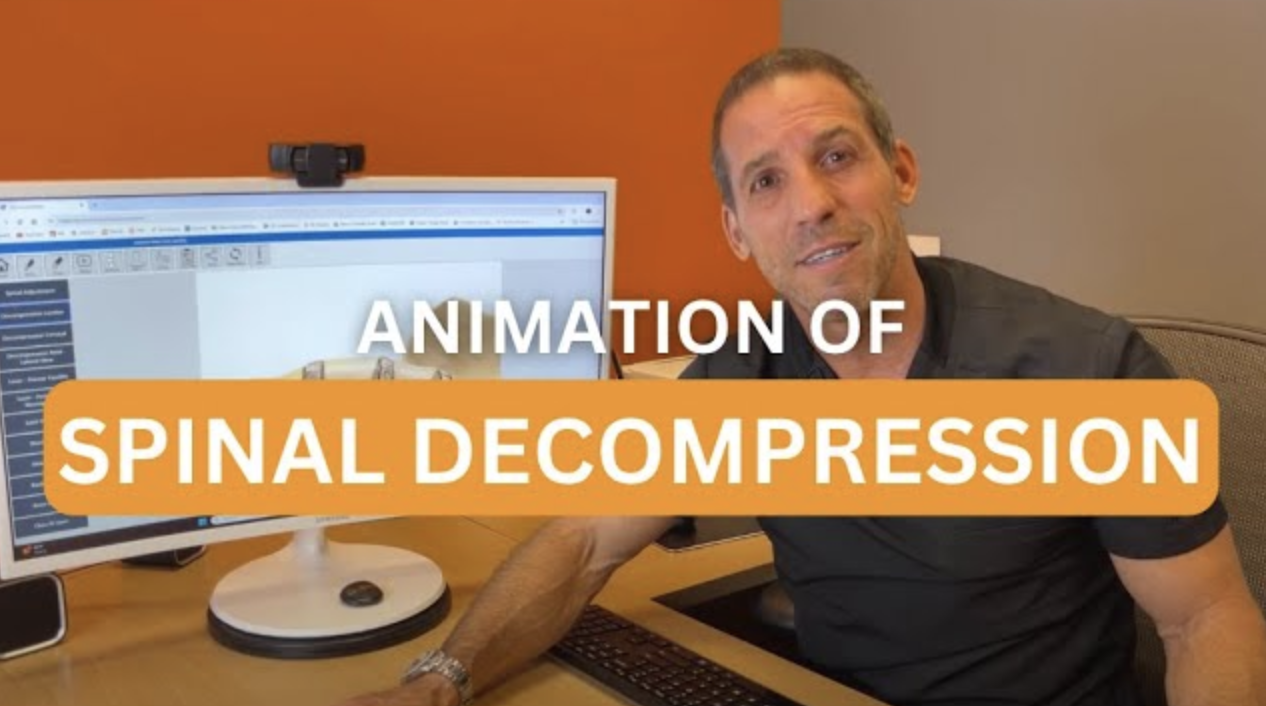 Animation of Spinal Decompression - Alter Chiropractic